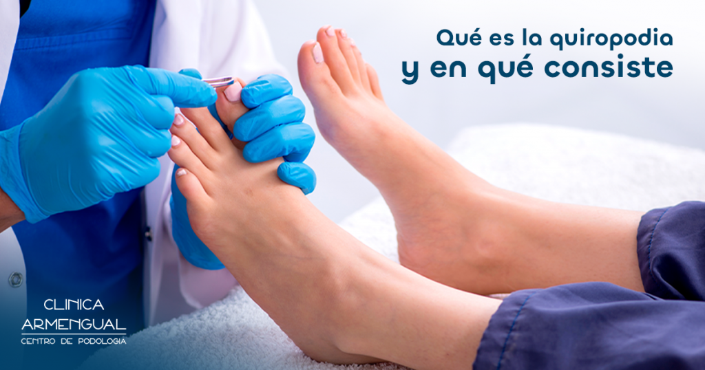 Qué es la quiropodia y en qué consiste | Clínica Armengual